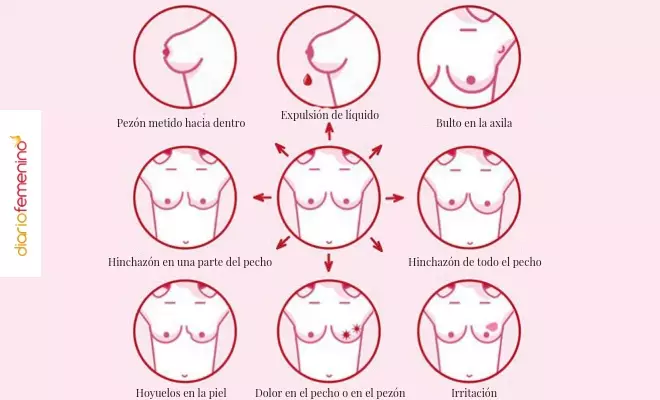 स्तनाच्या कर्करोगाची मुख्य लक्षणे