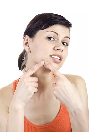 Scopri quali tipi di acne esistono