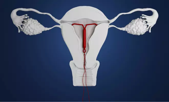 Instruksjoner for kontroll av IUD-strenger