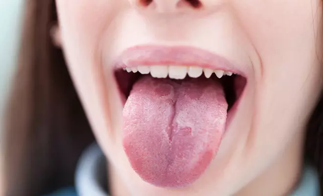 Язык - отличный индикатор вашего здоровья