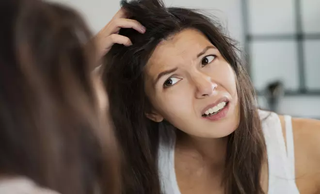 7 tips to prevent dandruff from coming back