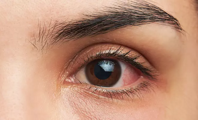 Gejala alergi eyeshadow