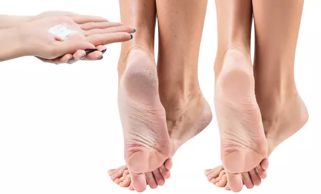 Vzroki in rešitve za glivice nohtov na rokah in nogah