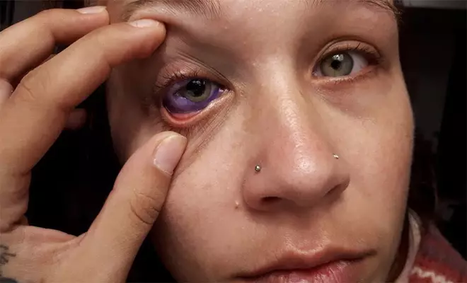 Nevarnosti očesnih tetovaž: primer Cat Gallinger
