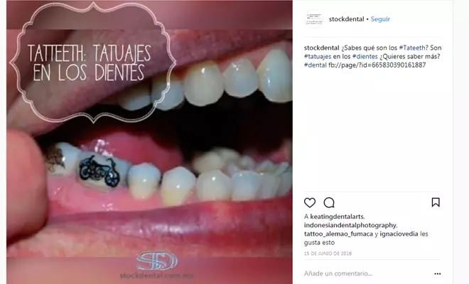 Tatteeth o tatuatges a les dents