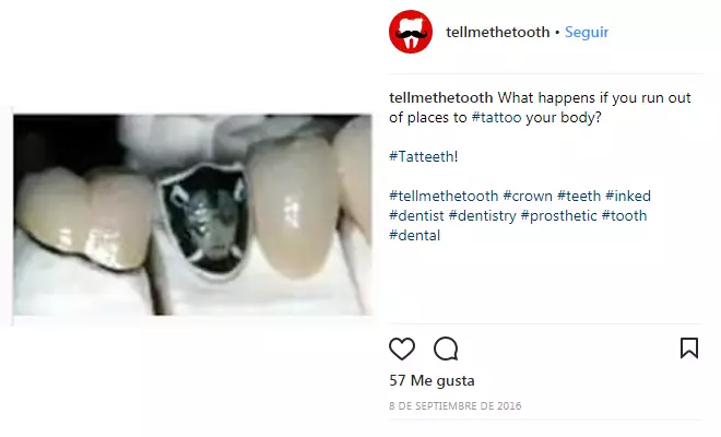 Tatteeth atau tato di gigi