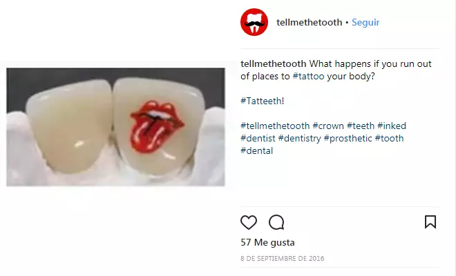 Tatteeth, et faries un tatuatge dental? 13297_9