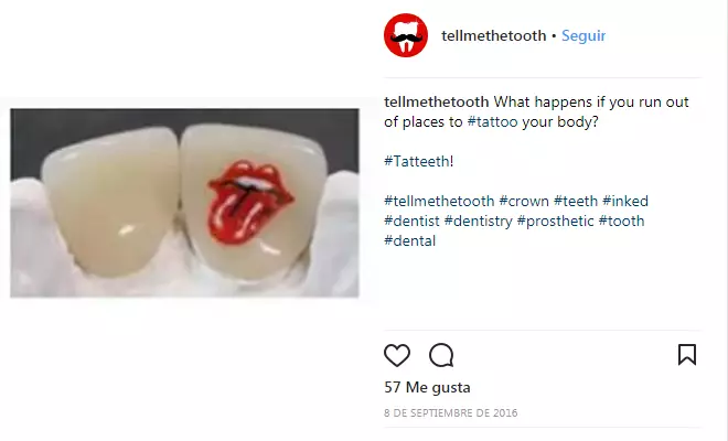 Tatteeth, sal jy 'n tandheelkundige tatoeëermerk kry? 13297_9