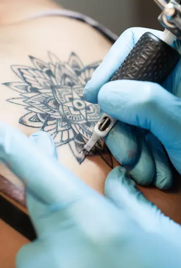 Tetovaže: kako izbrisati tetovaže z laserjem