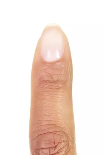 손톱에 잔물결이 생기는 이유는 무엇입니까?