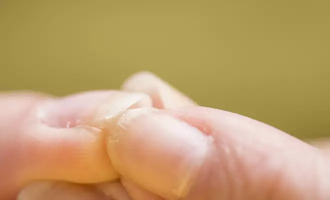 Поради щодо догляду за нігтями, якщо у вас є брижі
