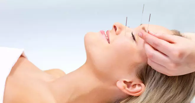 Akupunktur en menopoaze