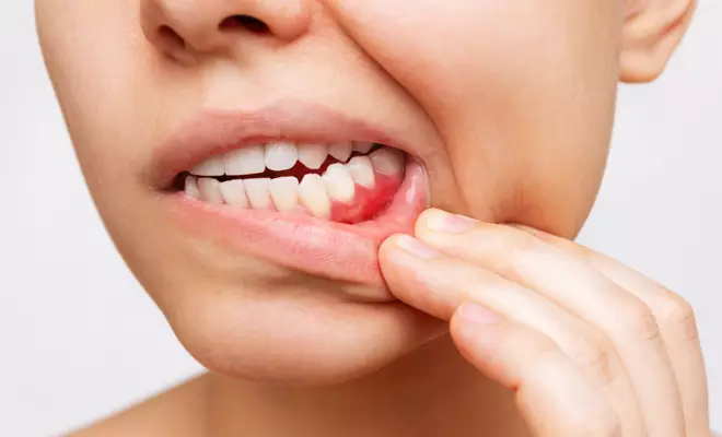 К чему снится шатающиеся нижние зубы?