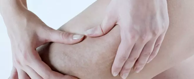 Маскаҳои cellulite