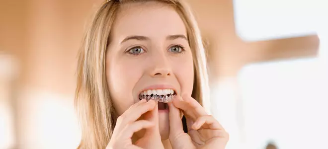 Kesgitlenen ýa-da aýrylýan ortodontika: artykmaçlyklar we kemçilikler