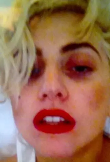 Lady Gaga. L-aktar inċidenti assurdi fuq il-palk