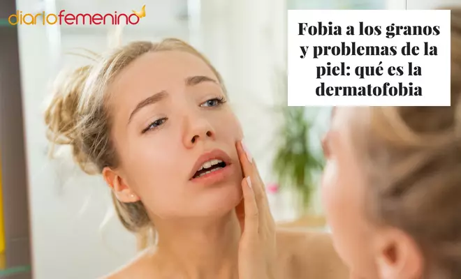 Fobija pred mozolji in težavami s kožo: kaj je dermatofobija