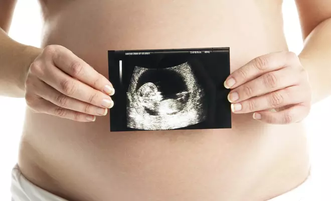 Задержка месячных: беременна ли я?