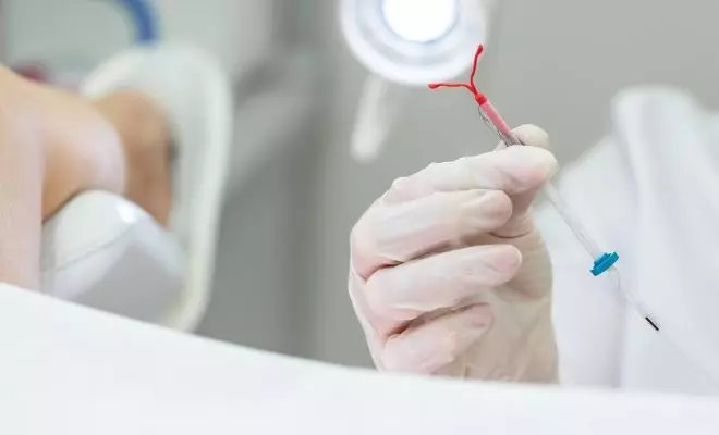 IUD ಅನ್ನು ತೆಗೆದುಹಾಕಲು ವಿವಿಧ ಕಾರಣಗಳು