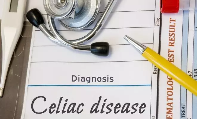 Diagnosis and treatment of celiac disease