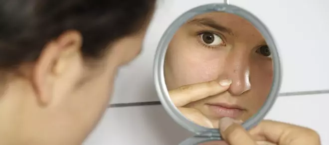 Trucos caseiros para desfacerse do acne nos adolescentes
