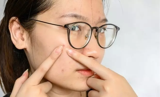 Acne from wearing glasses: useful tips to avoid the dreaded glasscné
