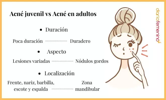 Diferenzas entre acne adulto e acne xuvenil