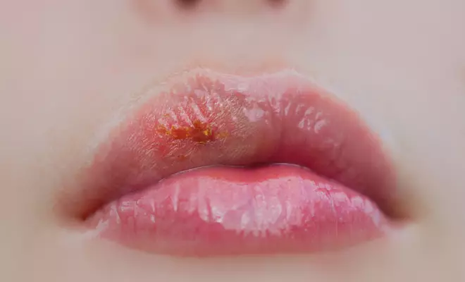 你的嘴唇揭示了你的健康狀況：嘴唇腫脹