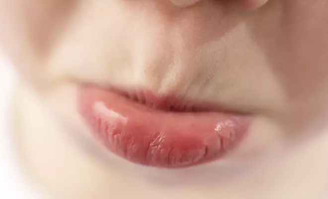 आपके होंठ आपके स्वास्थ्य के बारे में क्या बताते हैं: फटे होंठ