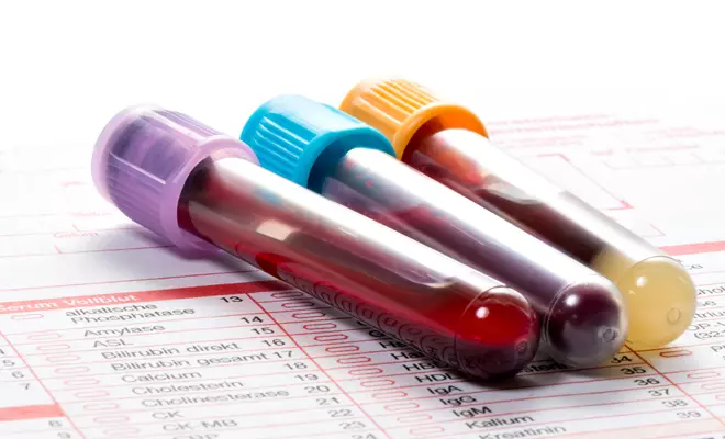 Kan testi öncesi öneriler