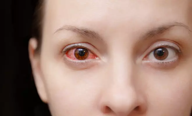 Bardzo skuteczne rozwiązania dla efektu czerwonych oczu