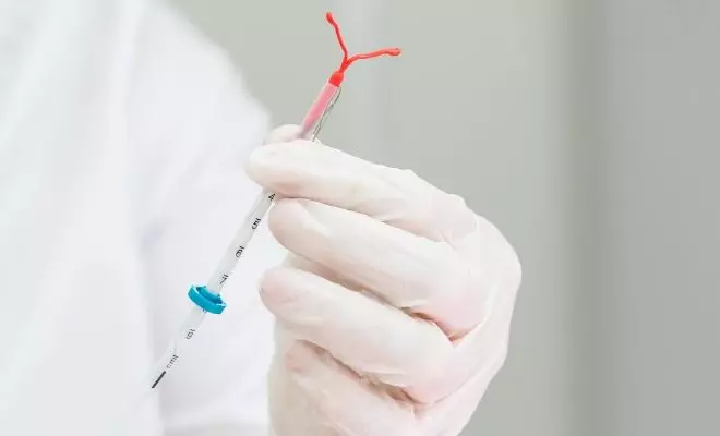 در مورد گذاشتن IUD چه چیزهایی باید بدانید؟