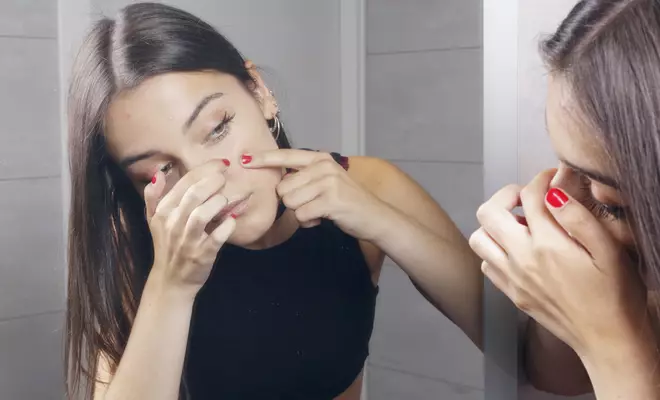 4 tricks til at fjerne bumser fra ansigtet uden at efterlade mærker