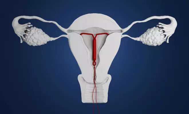 Czy wkładka domaciczna i miseczka menstruacyjna są kompatybilne?
