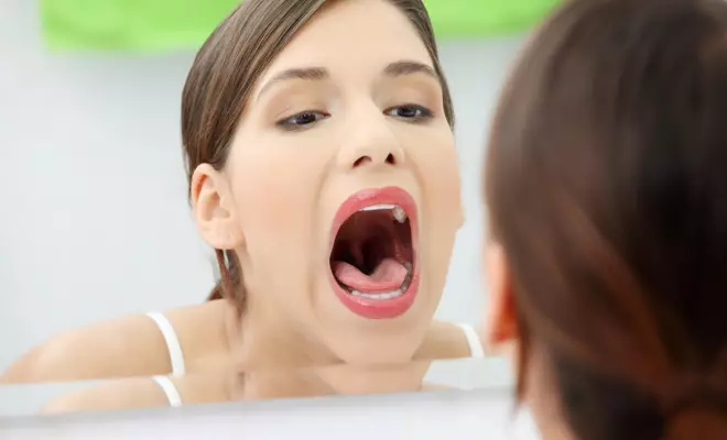 舌にいぼが現れる原因
