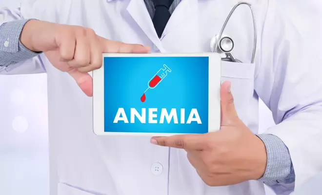 Zer da anemia eta zenbat denbora behar da sendatzeko?