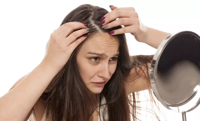 Why do you suffer from alopecia? Most common reasons