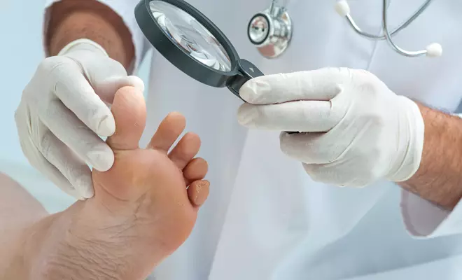 Най-доброто лечение за гъбички по ноктите на краката